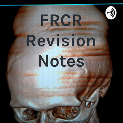 Bone and soft tissue lesions by FRCR Revision Notes