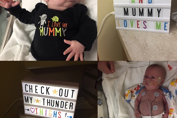 Miracle baby Kaio, born at 24 weeks, meets big sister & goes home from ...