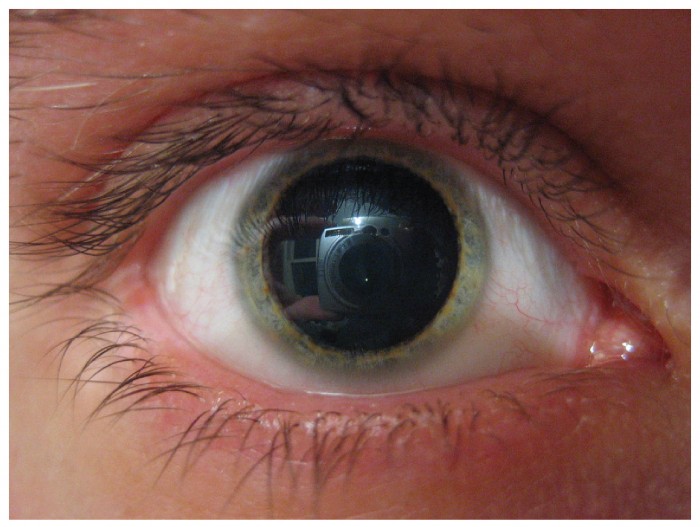 Pupil Dilation Meaning Unarehp