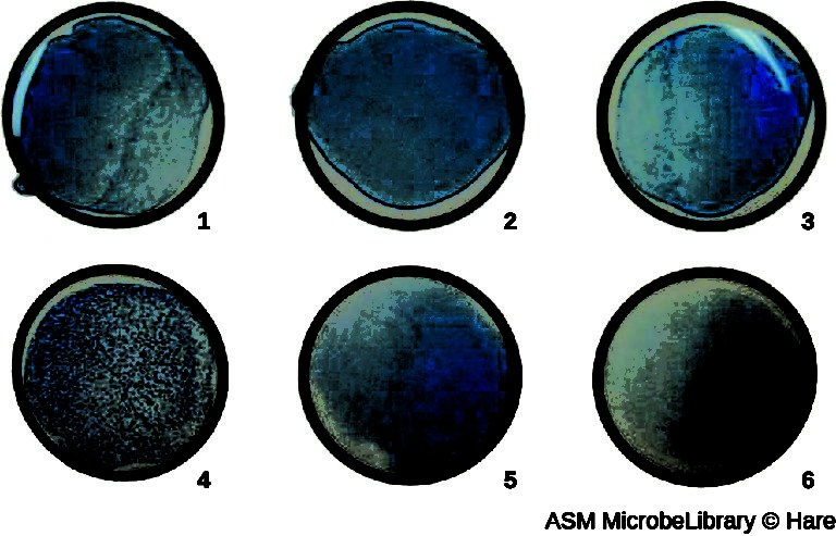 Agglutination Assays | Microbiology