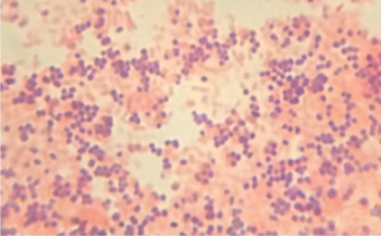 Staining Microscopic Specimens | Microbiology