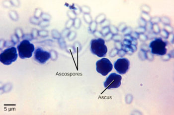 Ascomycota: The Sac Fungi | Biology for Majors II