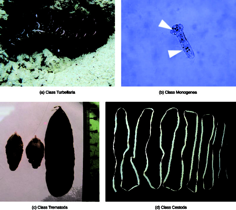 Phylum Platyhelminthes | Biology for Majors II