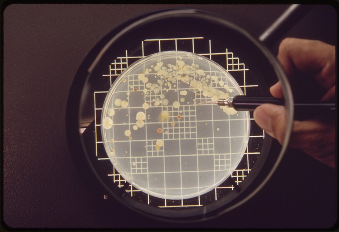 Which Of The Following Can Be Used To Estimate The Number Of Microorganisms In A Culture 