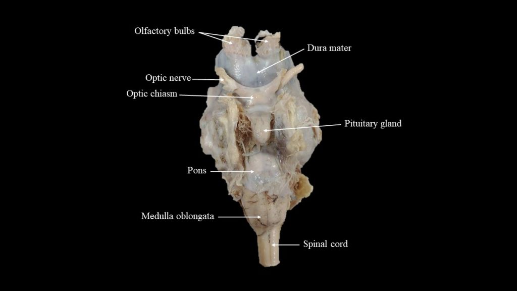 Sheep brain | Atlas of Comparative Vertebrate Anatomy
