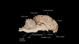 Sheep brain | Atlas of Comparative Vertebrate Anatomy