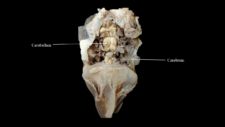 Squalus brain | Atlas of Comparative Vertebrate Anatomy