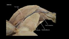 Cat musculature | Atlas of Comparative Vertebrate Anatomy