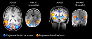 Physical Growth and Brain Development in Infancy | Lifespan Development