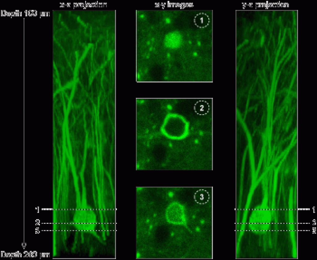 Multiphoton Microscopy Market Analysis by: Bruker, Nikon, Carl Zeiss ...
