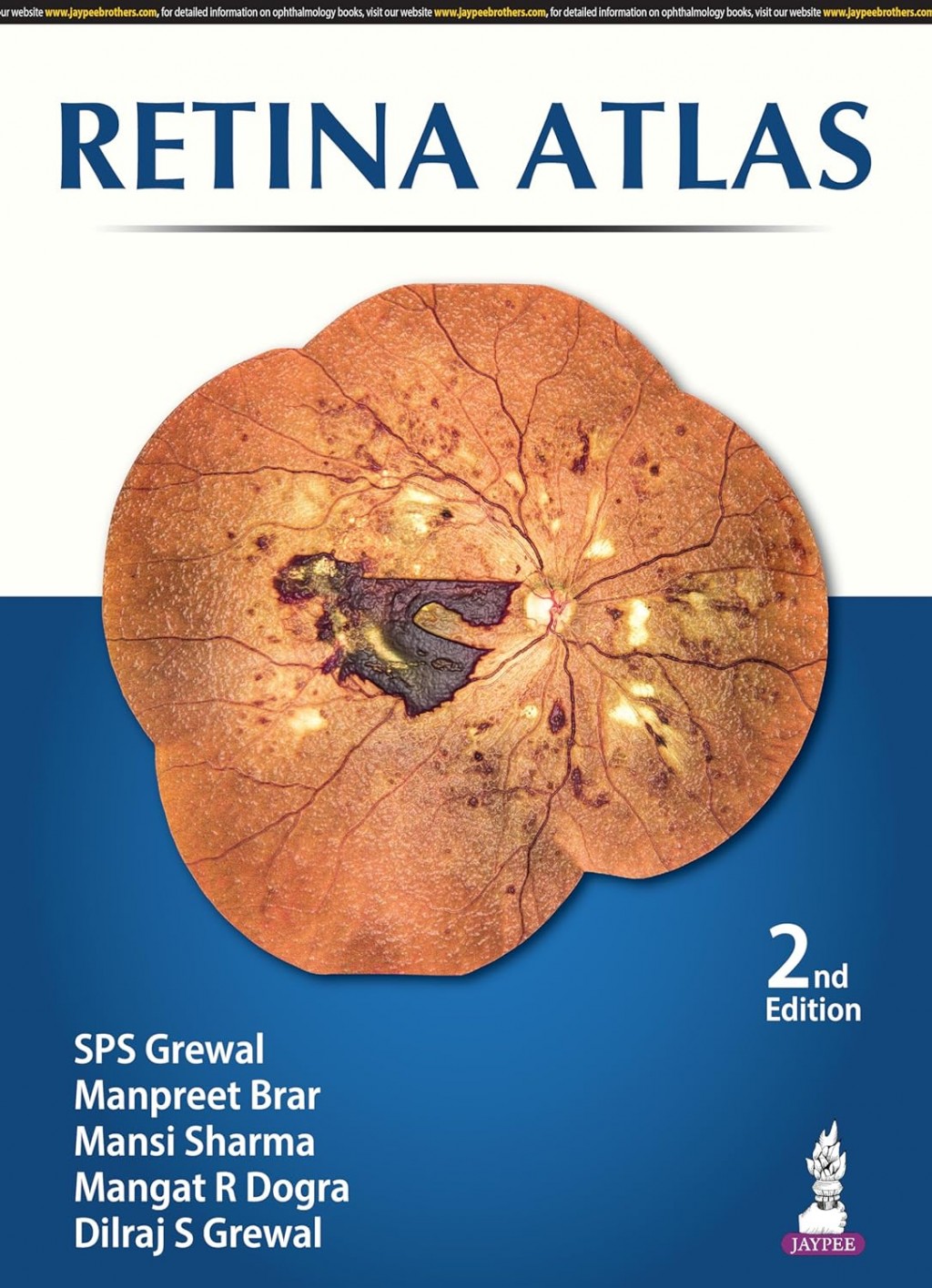 Retina Atlas (2nd Edition) Unveiled by Leading Ophthalmologists - IssueWire