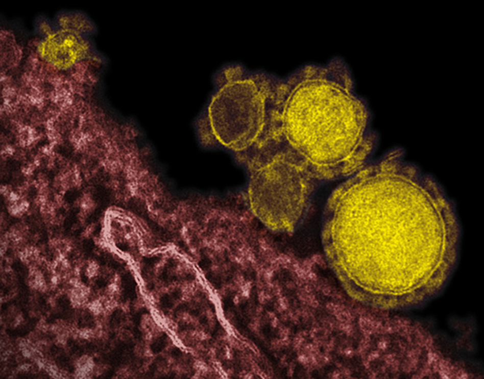MERS Virus Appears To Have Jumped From Human To Human In U.S.
