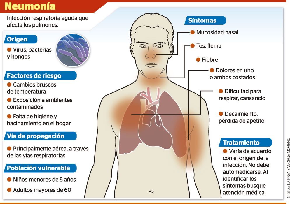 Biología Molecular: Neumonía por Neumococo