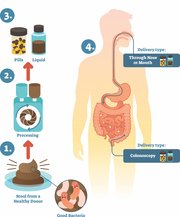 Fecal transplants: Separating hype from reality | Digestive | UT ...