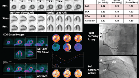 6 key heart tests and what they show | UTSW Medblog