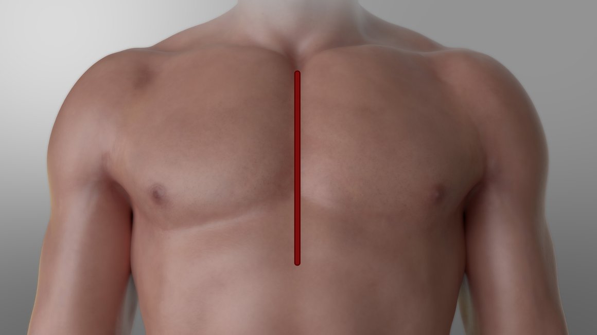 Heart valve surgery without cracking open the chest | Heart | UT ...