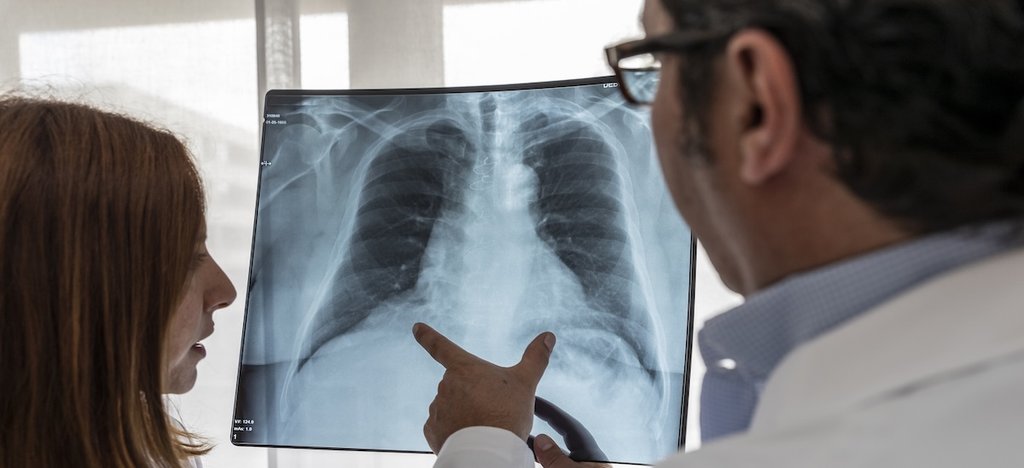 Thoracic Surgery at THD | Dallas, Texas | UT Southwestern Medical Center