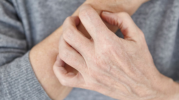 Autoimmune Skin Diseases | Condition | UT Southwestern Medical Center